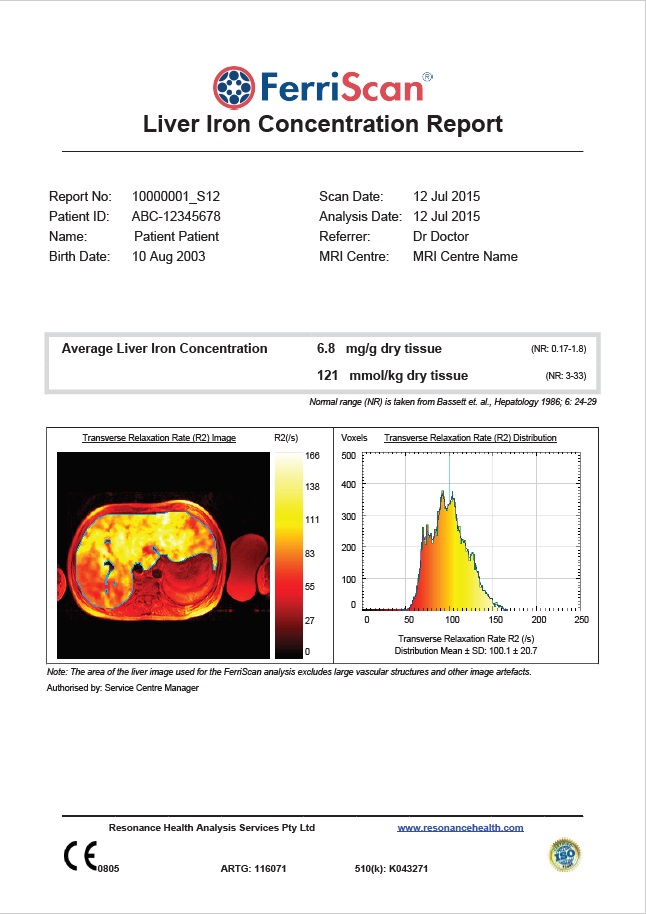 Resonance Health signs US distribution deal for its product following ...