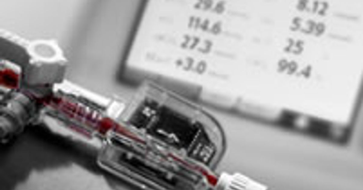 Sphere Medical appoints new CEO as founder Stuart Hendry steps down ...