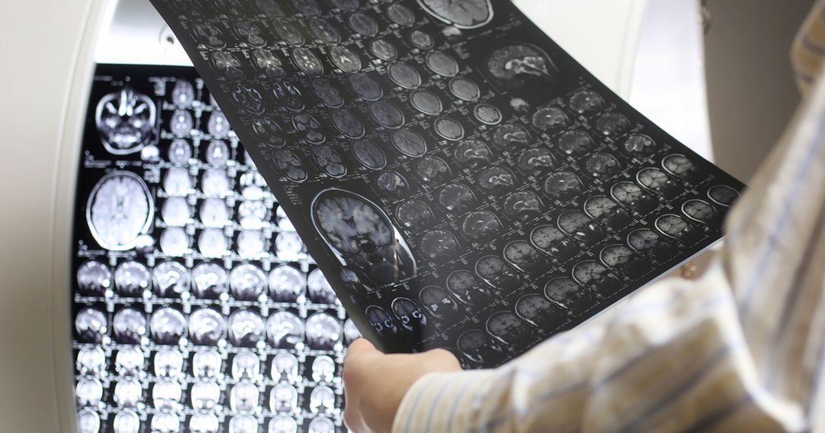 Cogstate Ltd to update on submission to U.S. FDA | ASX:CGS