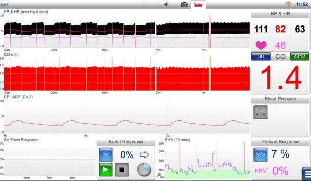 LiDCO secures two new contracts in the US as its new offering gains ...