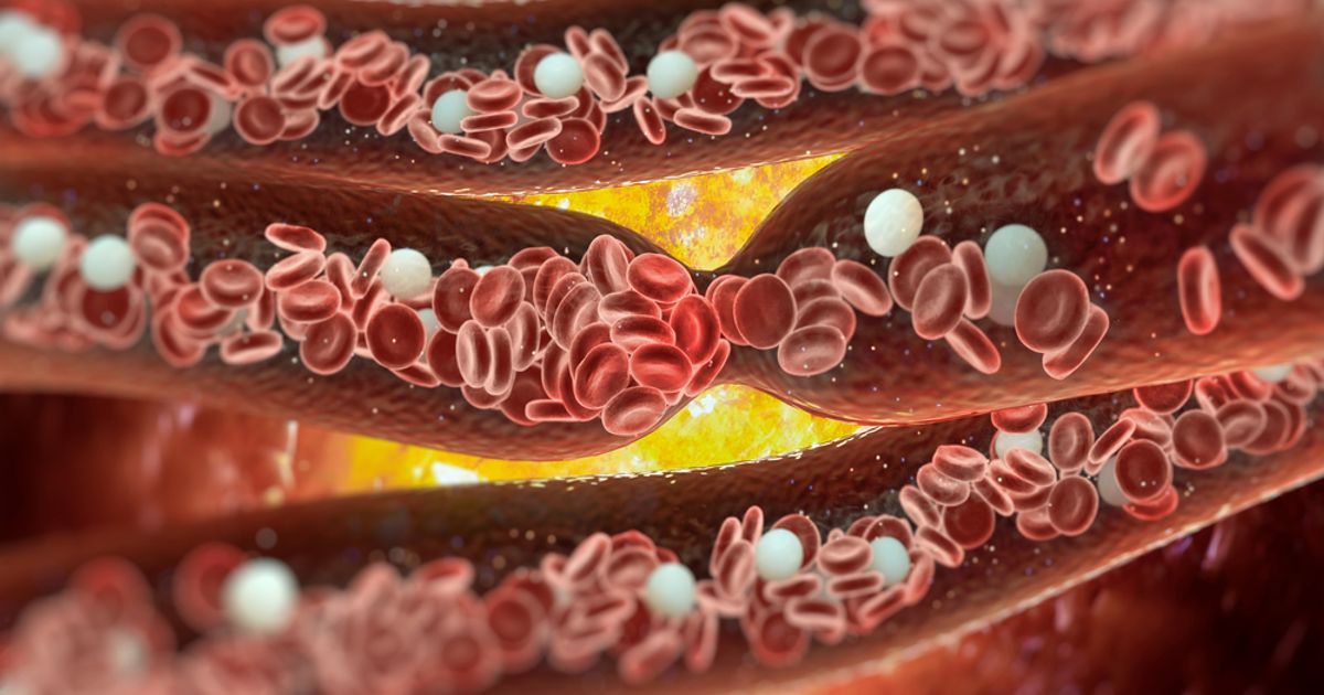 BTG snaps up medical device maker Novate for up to US$150mln | LSE:BTG