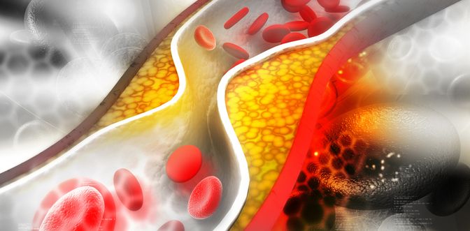 Amryt Pharma PLC’s Lojuxta ‘bad’ cholesterol treatment to be made ...