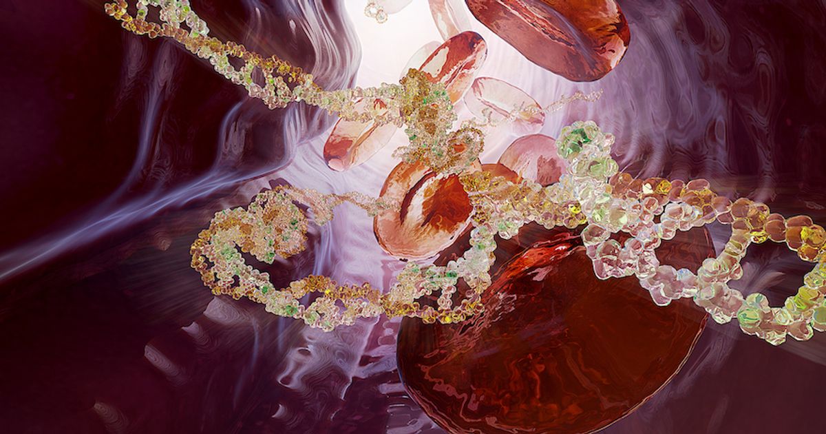 ANGLE’s Parsortix system could help “significantly improve” diagnosis ...