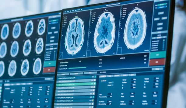 IXICO to present three posters at California Alzheimer's conference ...