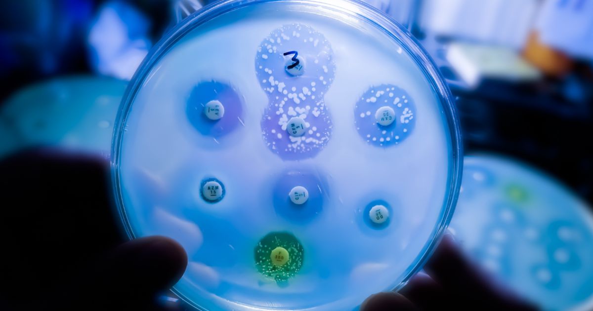 Recce Pharmaceuticals selected to participate in UK Government ...