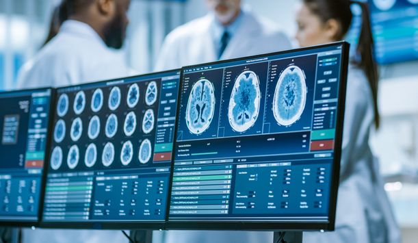 Nexalin Technology's neurostimulation device shows promise in easing ...