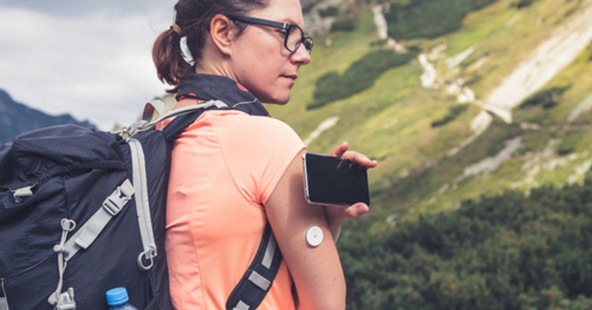 DexCom slashes full-year sales forecast, shares plummet | NASDAQ:DXCM ...