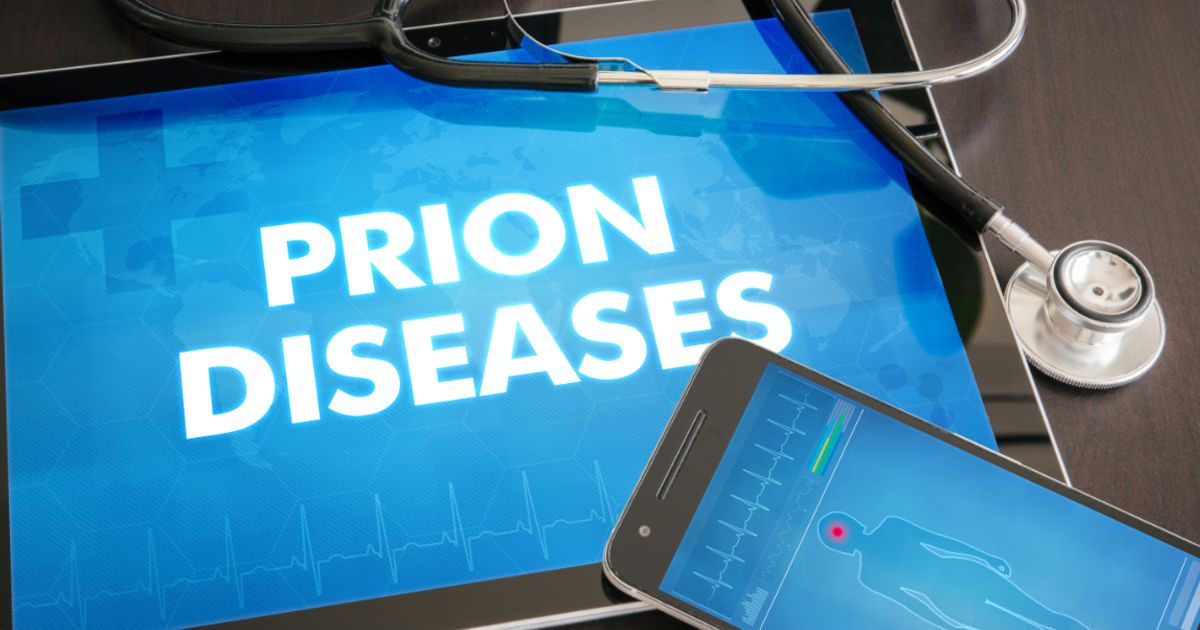 Researchers begin to unlock prion disease’s mysteries with early ...