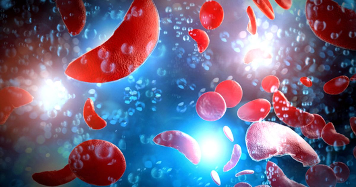 Emmaus Life Sciences obtains marketing authorization for sickle cell ...