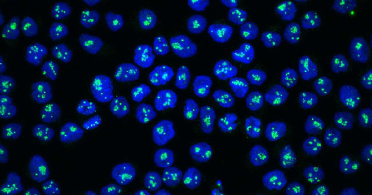 Researchers identify new pathway for acute lymphoblastic leukaemia ...