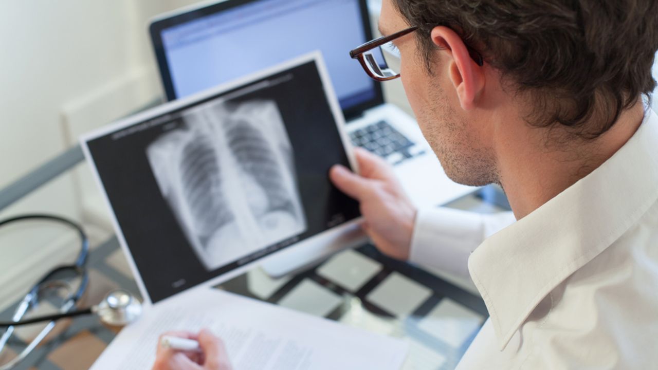 Regeneron shares plunge after mixed COPD drug trial results | NASDAQ:REGN