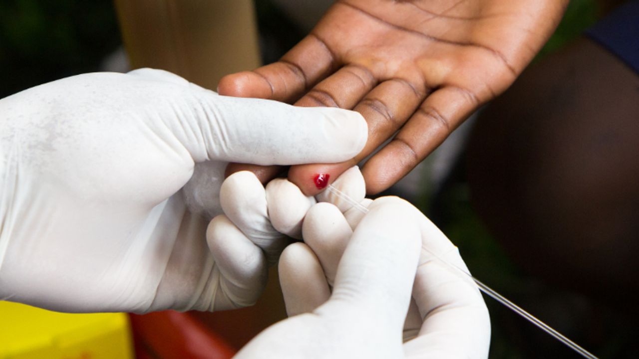 Oxford BioDynamics shares jump 118% after Pfizer validates blood-based ...