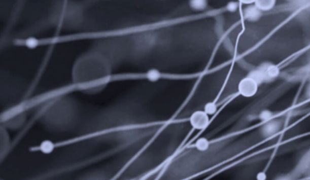 Tryptamine Therapeutics strengthens clinical development team | ASX:TYP ...