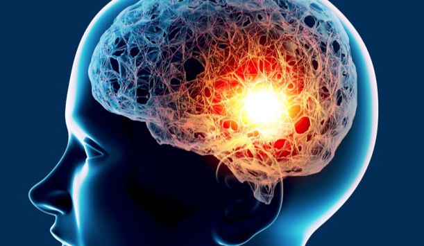 IXICO strikes key data deal with Alzheimer’s research group to bolster ...