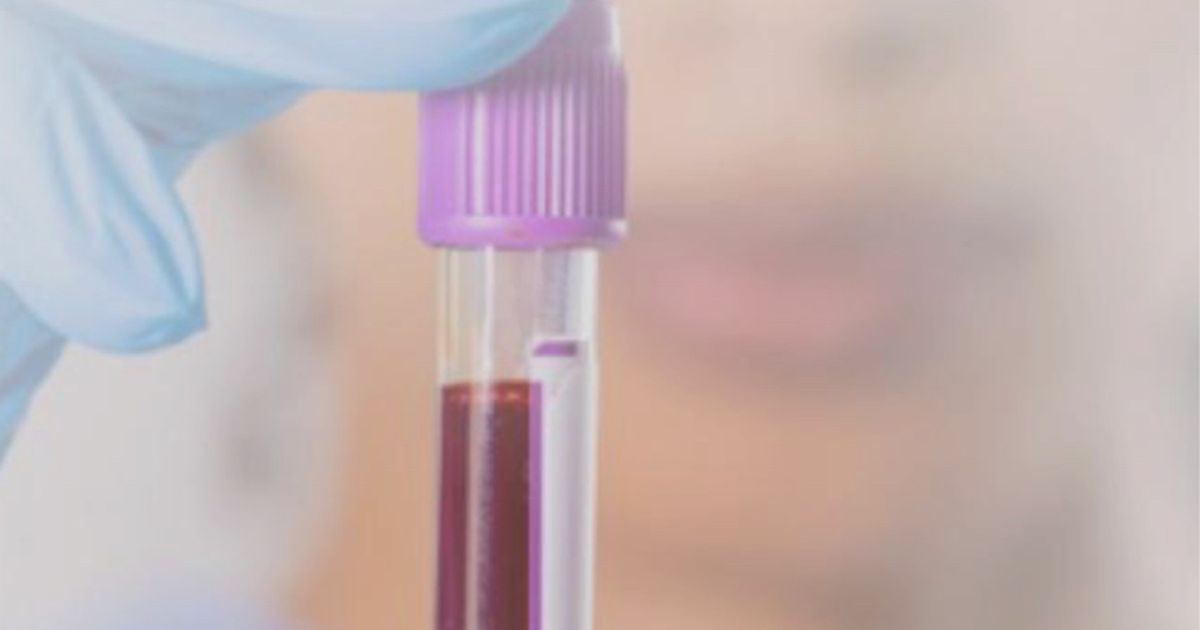BCAL Diagnostics partners with Sonic Healthcare to expand access to ...