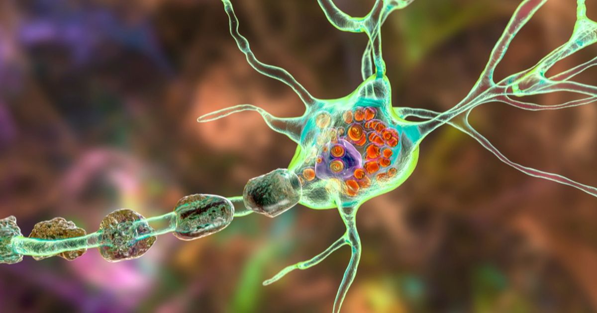 Protalix Biotherapeutics poised for profitability as rare disease drug ...