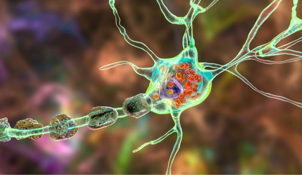 Protalix Biotherapeutics poised for profitability as rare disease drug ...