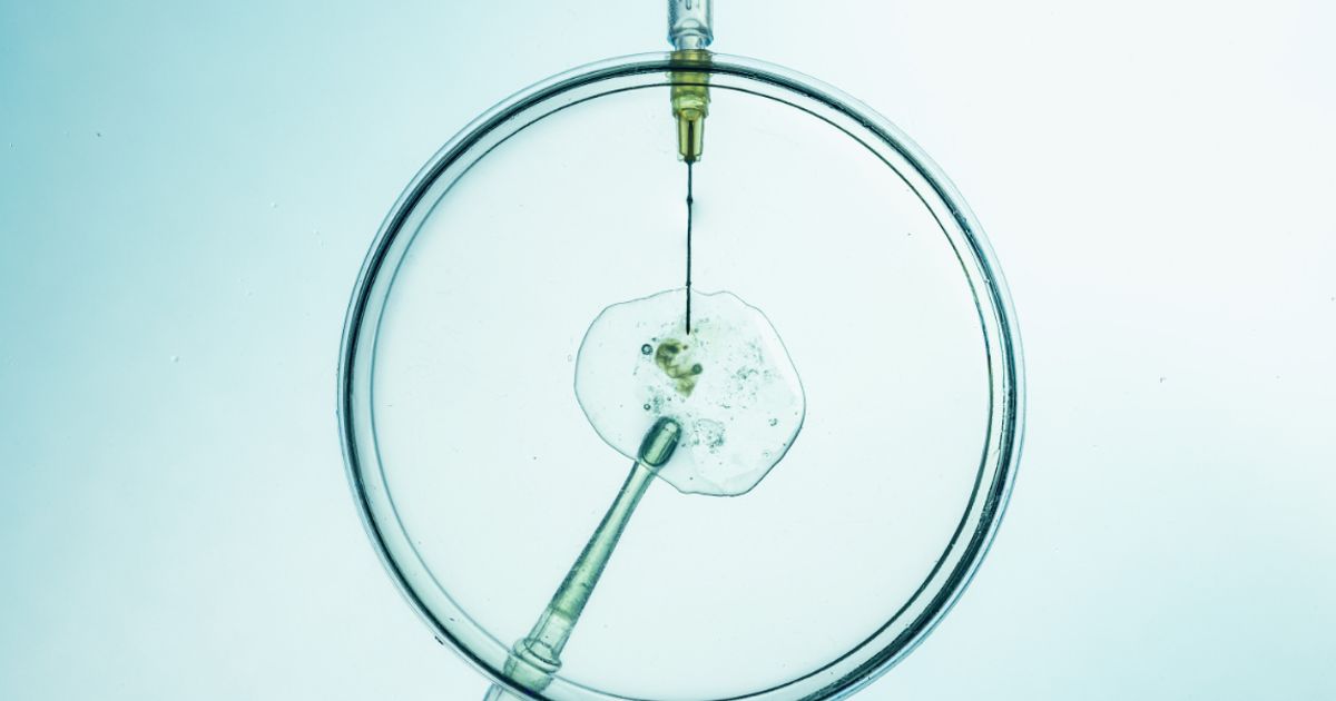 Inside Biotech: Monash IVF board flexes the bonus hammer after embryo ...