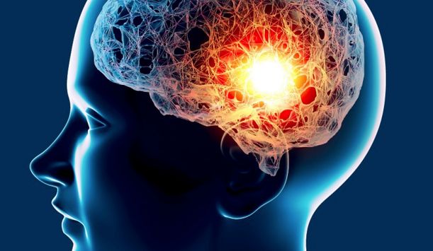 Algernon Health strikes US neuroimaging deal with AMI, closes first ...