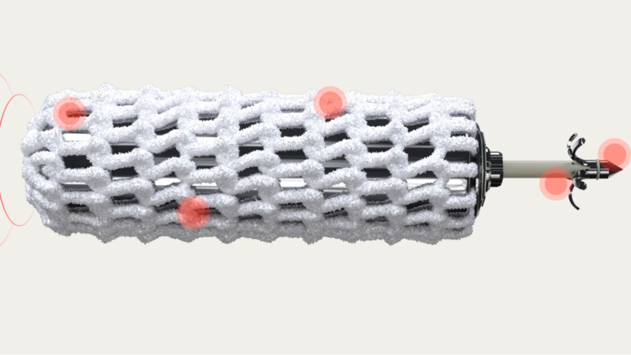 EBR Systems completes first Totally Leadless CRT implant in Australian ...
