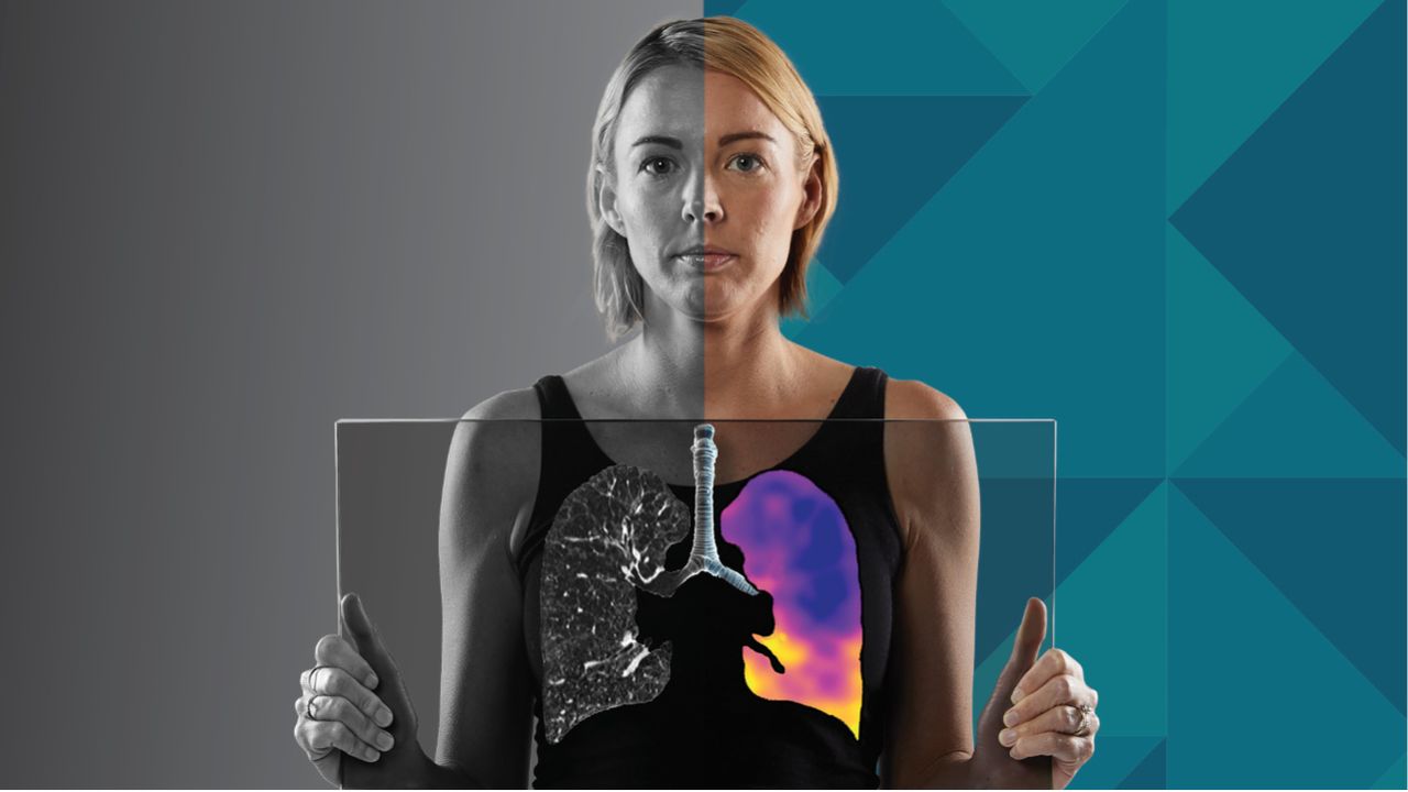 Inside Biotech: 4DMedical’s Mayo moment sharpens US push — and ...
