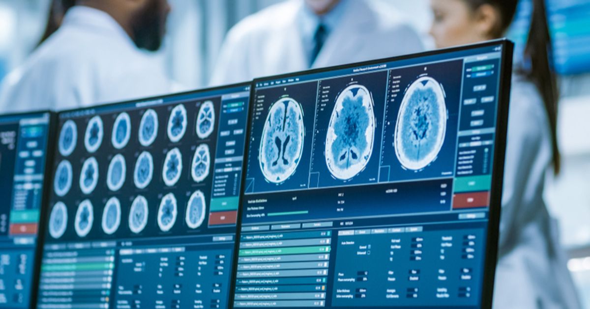 IQ-AI says Imaging Biometrics subsidiary gets IB Clinic software ...