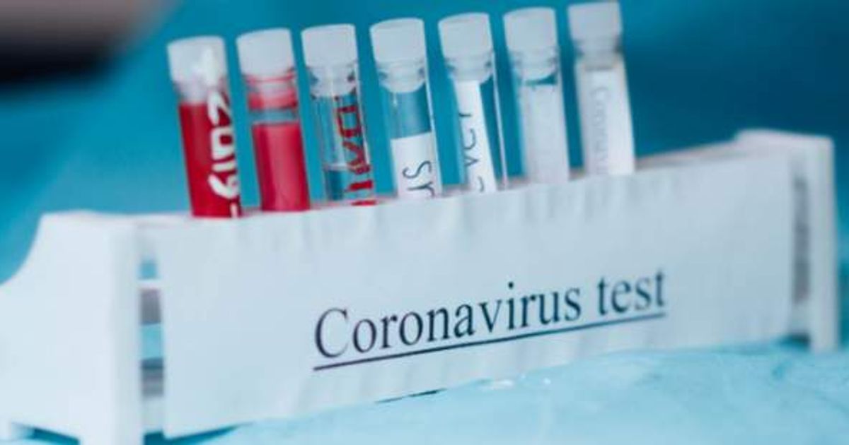 Co-Diagnostics says Logix Smart COVID-19 Test performance validated by ...