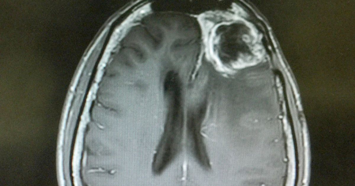 Kazia Therapeutics to collaborate with Cornell University for new ...