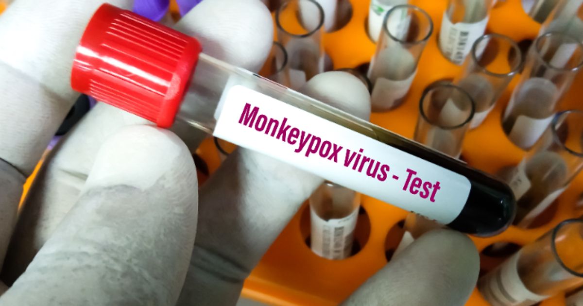 Co-Diagnostics develops principal design work on monkeypox PCR test ...