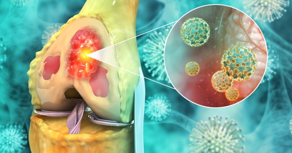 Radiopharm Theranostics shares surge after securing FDA's rare ...