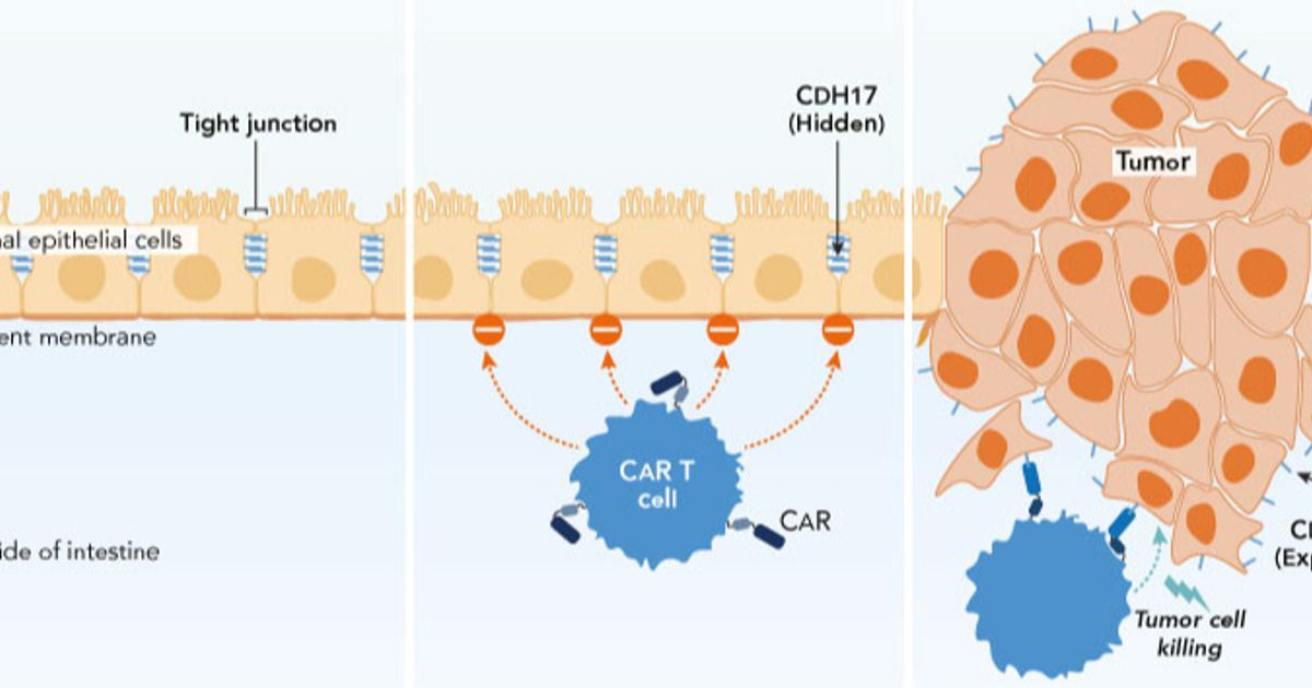 Chimeric Therapeutics outlines sponsored research agreement to advance ...