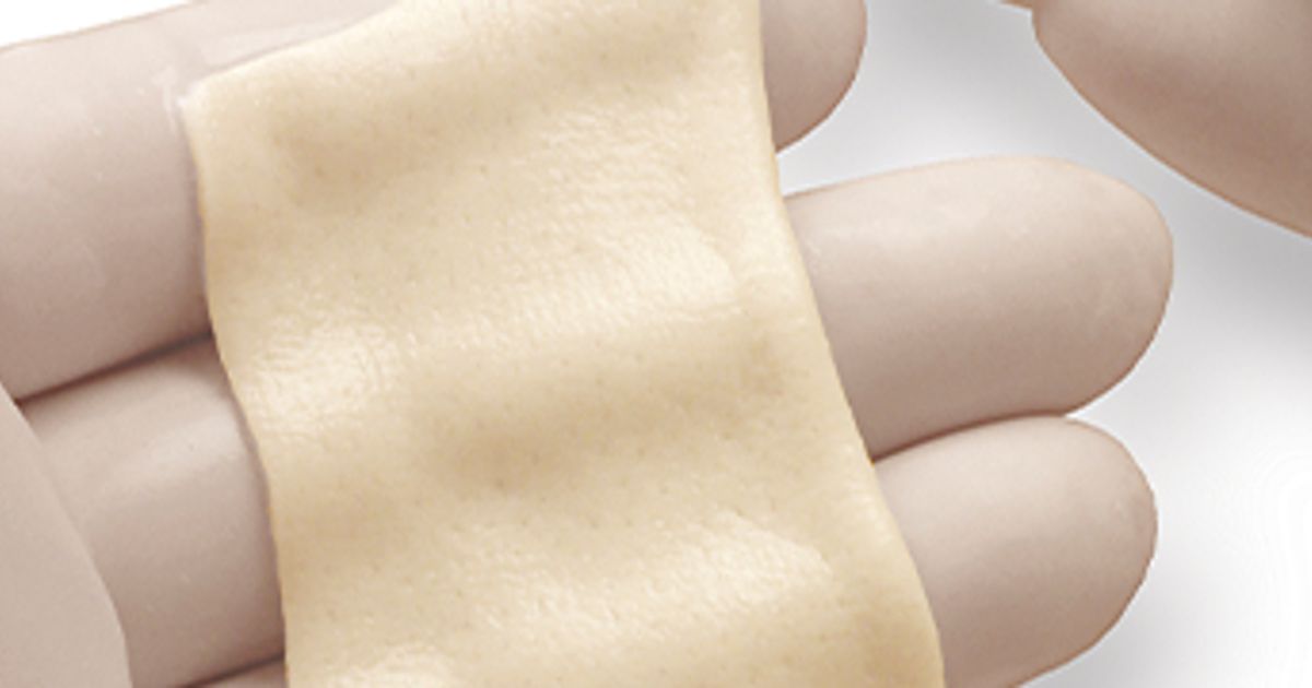 Tissue Regenix extends VNEW allograft range to support SUI treatments ...