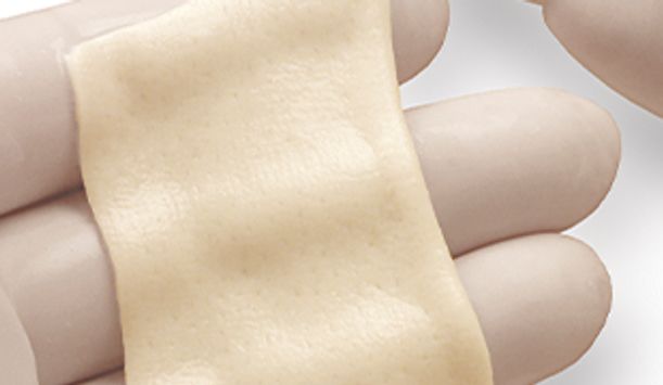 Tissue Regenix extends VNEW allograft range to support SUI treatments ...