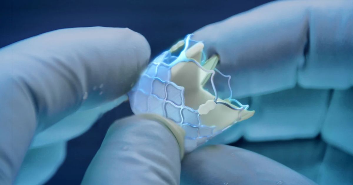 Anteris Technologies unveils encouraging FIH results from DurAVR™ heart ...