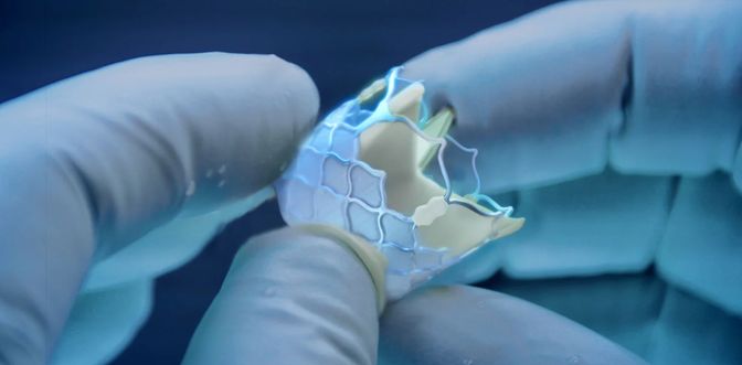 Anteris Technologies unveils encouraging FIH results from DurAVR™ heart ...