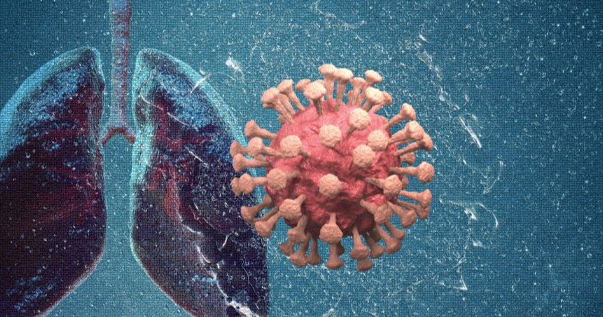 Imugene doses first combination patient in lung cancer clinical trial ...