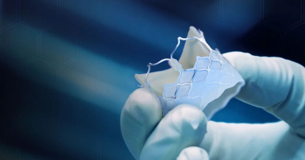 Anteris Technologies’ DurAVR heart valve used in life-saving valve-in ...