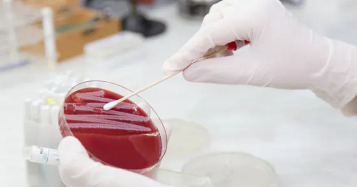 Recce Pharmaceuticals makes strides with R327G drug in multiple ...