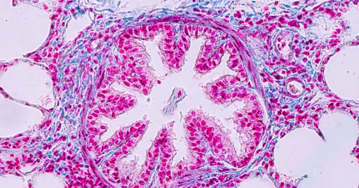 Nuformix says NXP002 evaluation gets underway | LSE:NFX