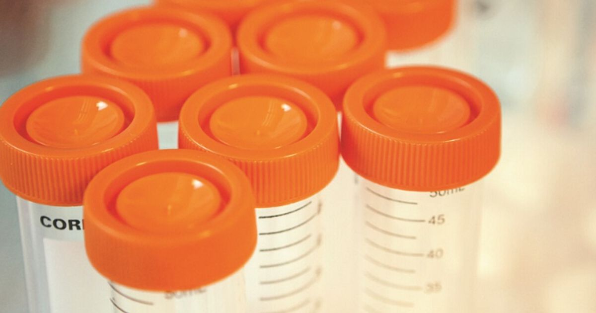 GSK, Aston Martin, Next and more: Day Ahead on Wednesday | LSE:GSK ...