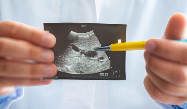 Imugene opens higher as novel cancer-killing virus VAXINIA is granted ...