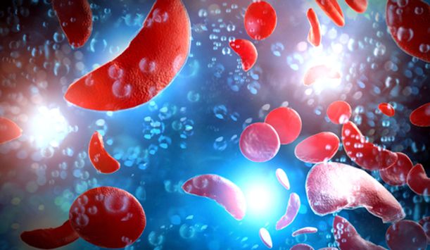 bluebird bio faces challenges despite sickle cell therapy approval ...