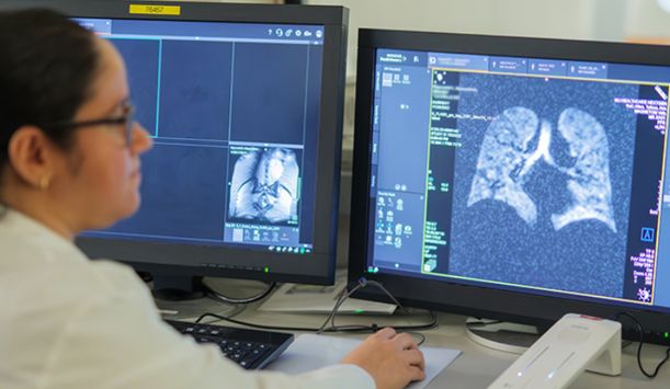 Polarean Imaging hails new polariser order from top US academic medical ...