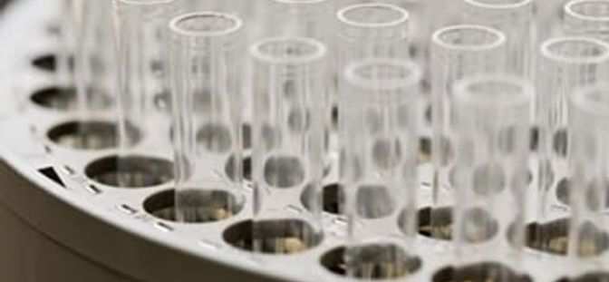 ReNeuron’s CTX stem cell line shows promise in pre-clinical data | LON:RENE