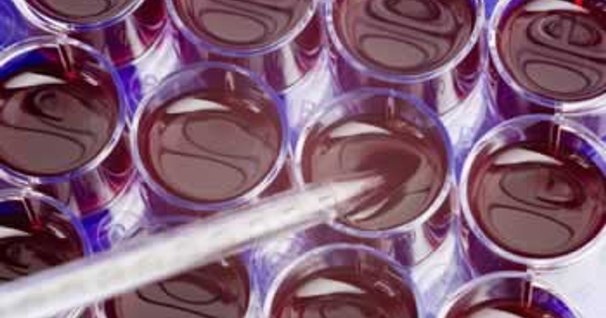 ReNeuron – playing its part in the stem cell revolution | LON:RENE