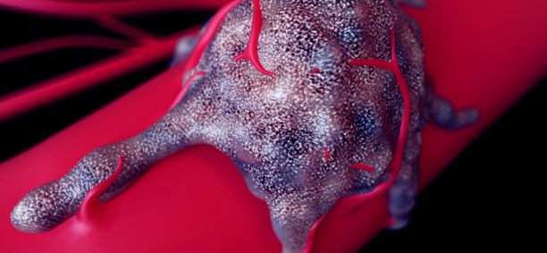 Biocept is changing the way physicians examine blood work for their ...